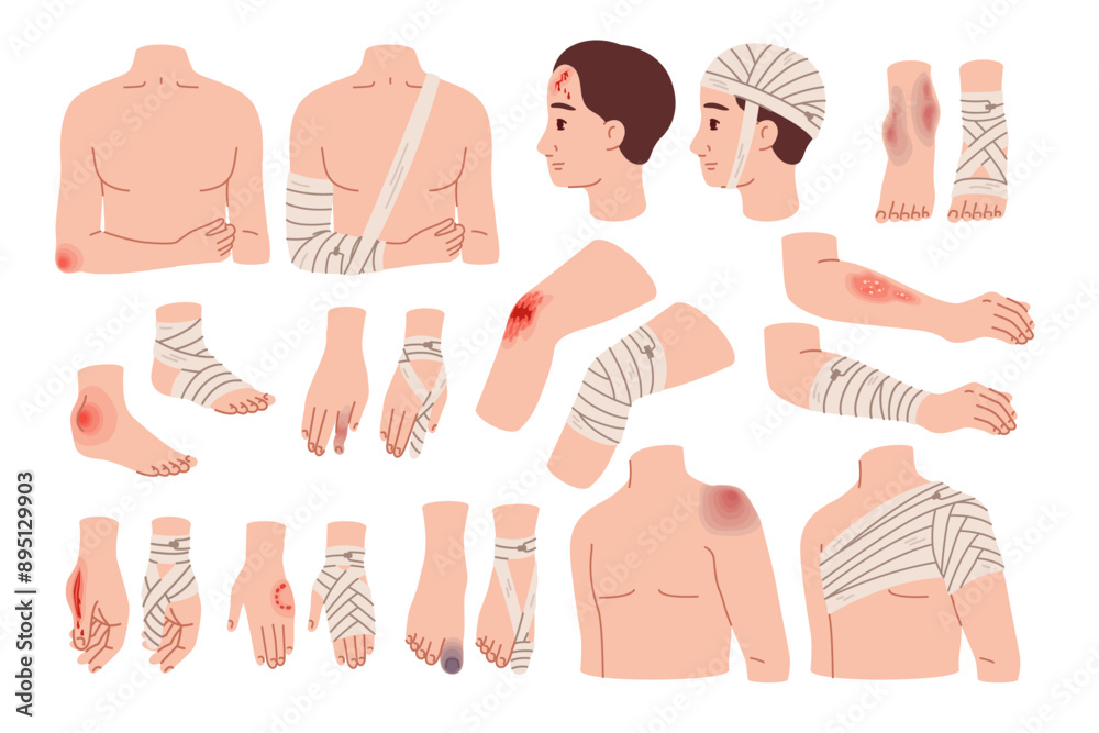 Applying bandages to wounds. Fixation and isolation of bruises. Bone ...