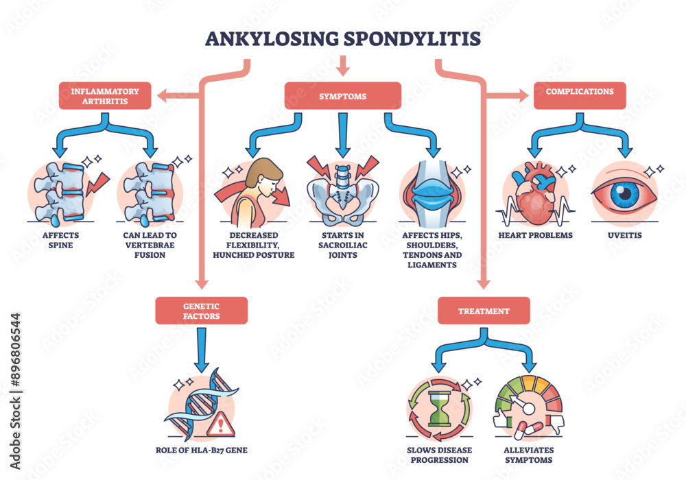 Ankylosing spondylitis as arthritis symptoms or complications outline ...
