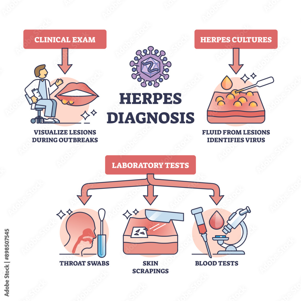 Herpes diagnosis and HSV virus medical diagnosis methods outline ...