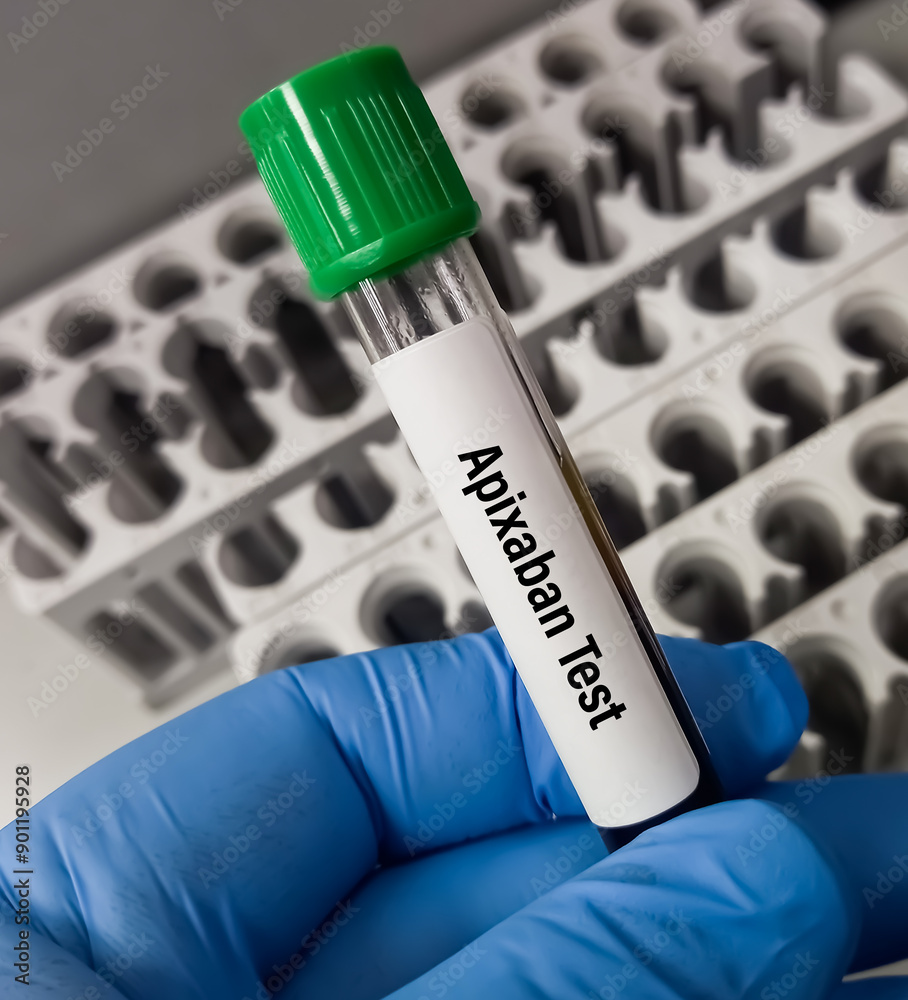 Blood sample for Apixaban level test. Measurement of drug level in ...