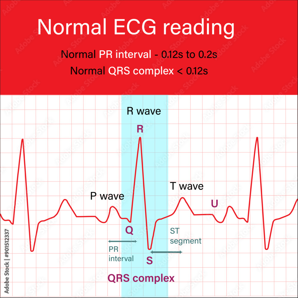 Normal ECG reading Cardiogram PR interval QRS complex Stock Vector ...