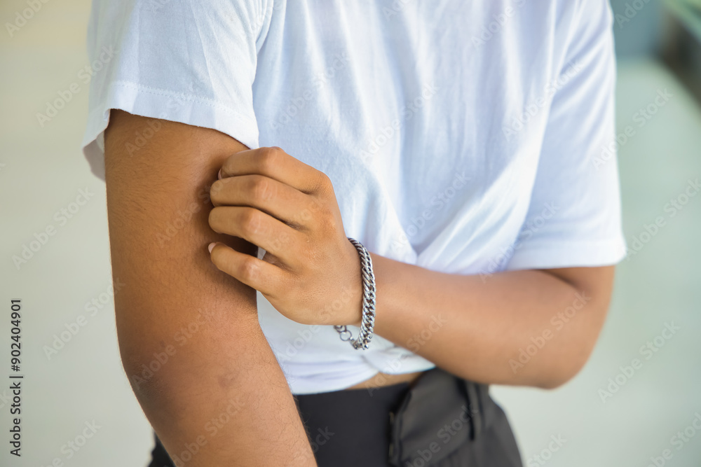 Young African woman scratching arm skin, concept of dry skin, allergic ...