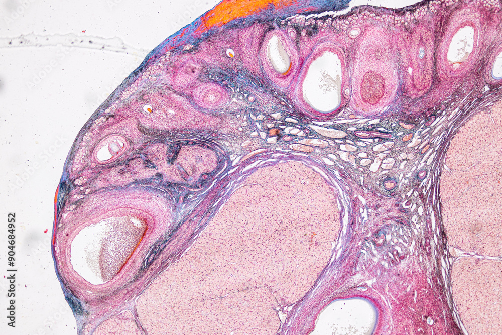 Foto de Anatomy and Histological Uterine tube, Uterus, Vagina, Ovary ...