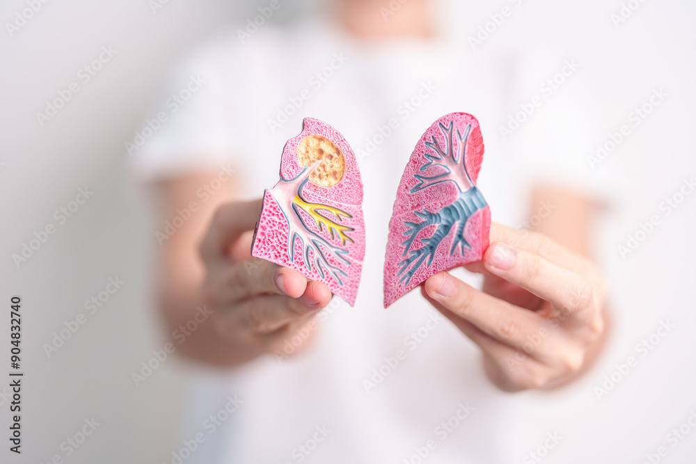 woman hold Smoker anatomy for Disease. Lung Cancer, Asthma, Chronic ...