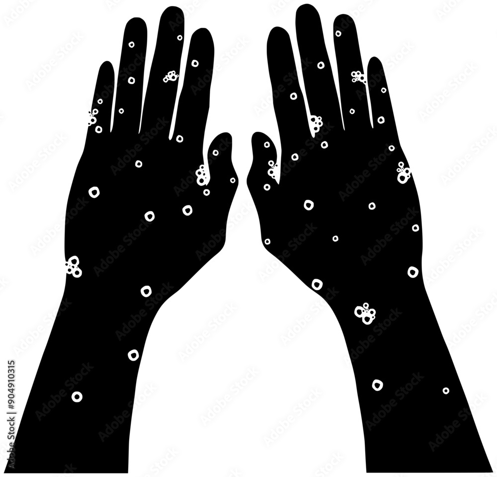 acne illustration illness silhouette virus logo skin icon pain outline ...