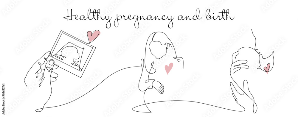 Vector one line art set of stages of halthy pregnancy and birth. One ...