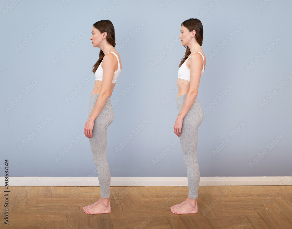 Poster Good posture and bad posture of a woman, side view – Wall Art ...