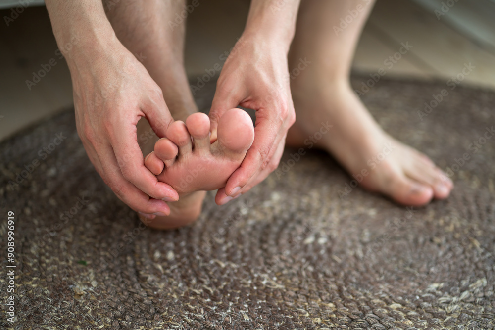 Foot pain, corns and calluses, dry skin on legs, man suffering from ...