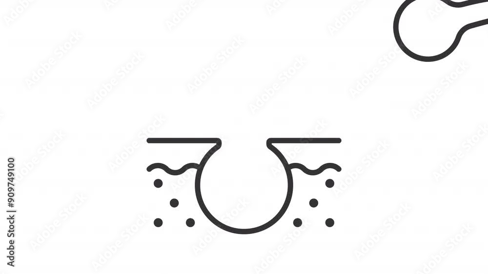 Hair loss line animation. Receding hairline animated icon. Shaking ...