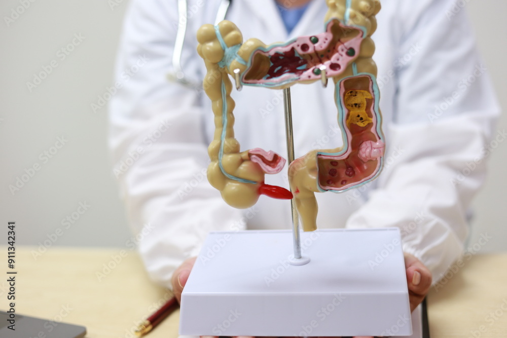 The intestine, comprising the small and large intestines, is a long ...