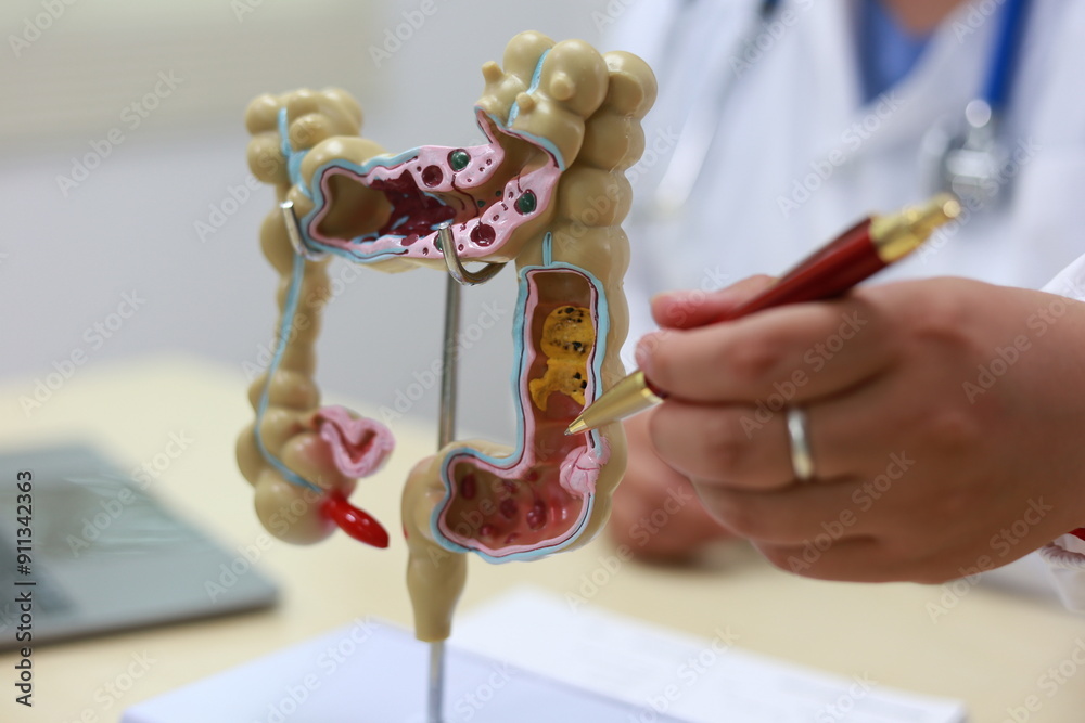 The intestine, comprising the small and large intestines, is a long ...