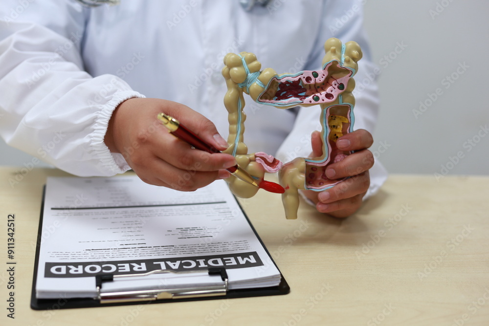 The intestine, comprising the small and large intestines, is a long ...