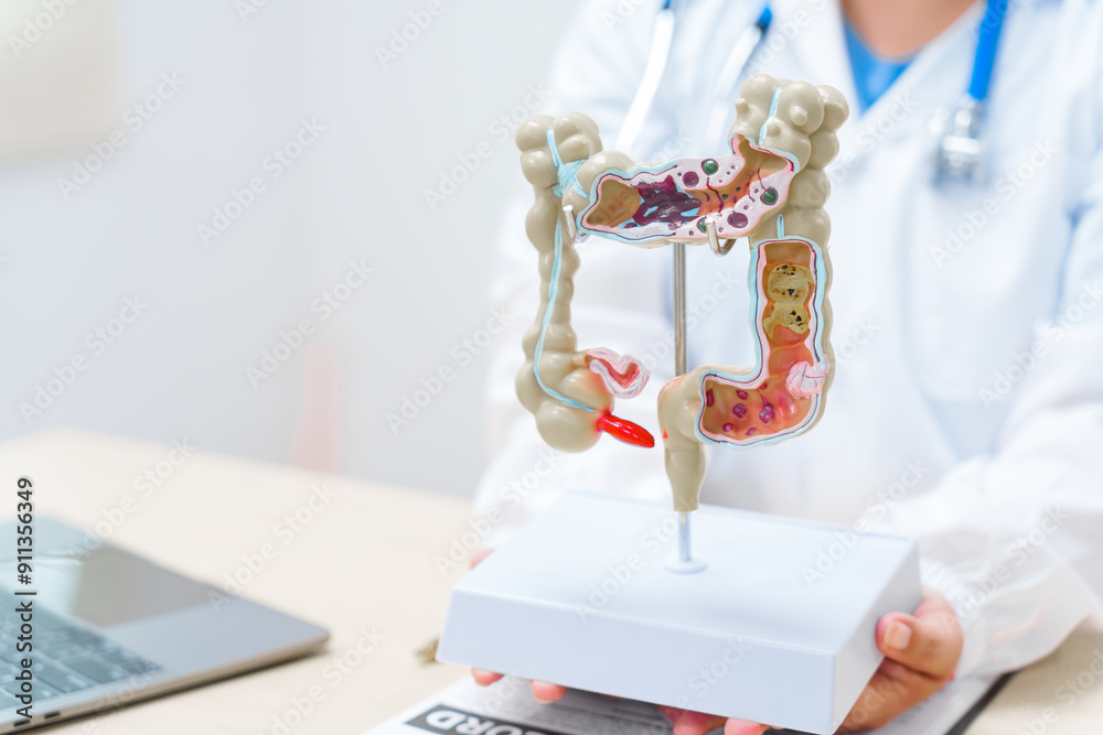 A doctor holds a human colon anatomy model, demonstrating the digestive ...