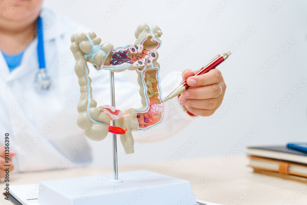 Poster A doctor holds a human colon anatomy model, demonstrating the ...