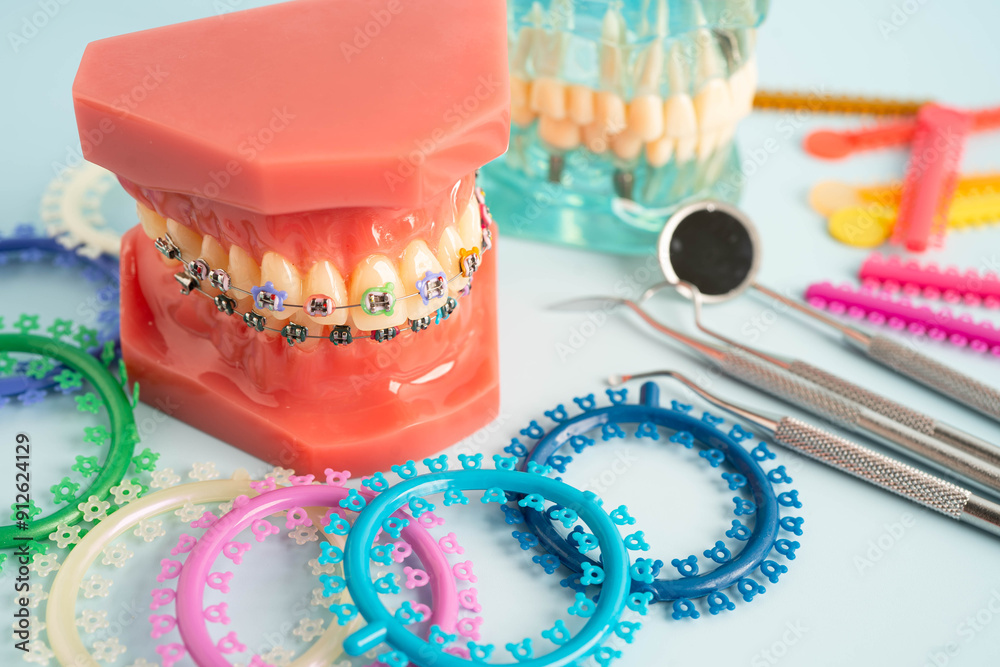 Orthodontic ligatures rings and ties, elastic rubber bands on ...