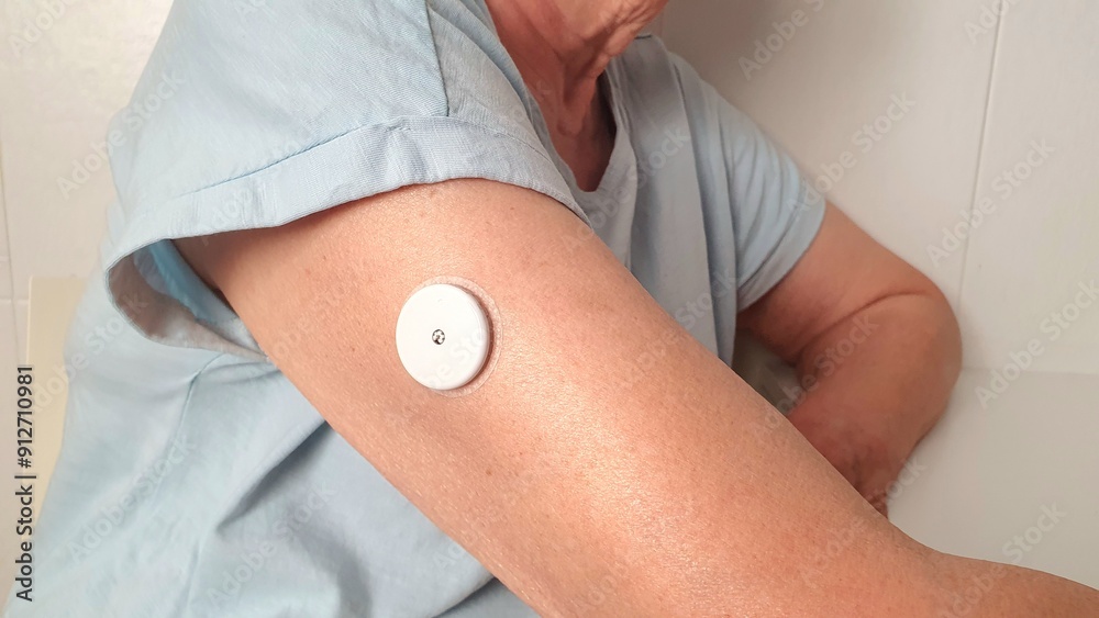 Non-contact glucometer on the arm for quickly measuring blood glucose ...