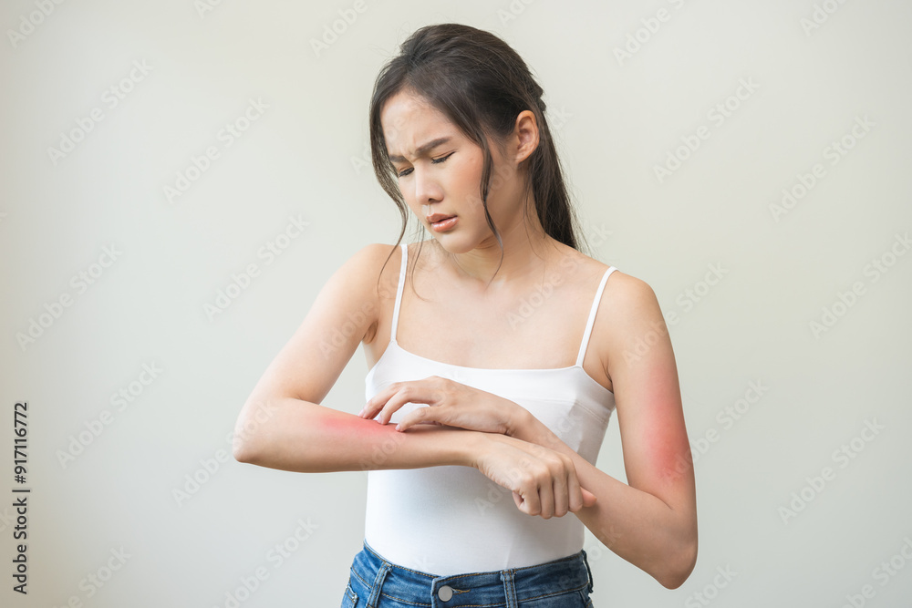 Dermatology asian young woman, girl allergy, allergic reaction from ...