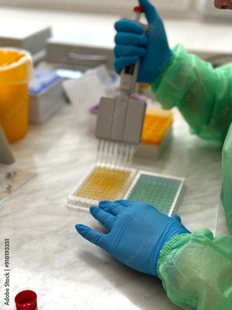 Elisa antibody test. Disease diagnostics. Enzyme-linked immunosorbent ...