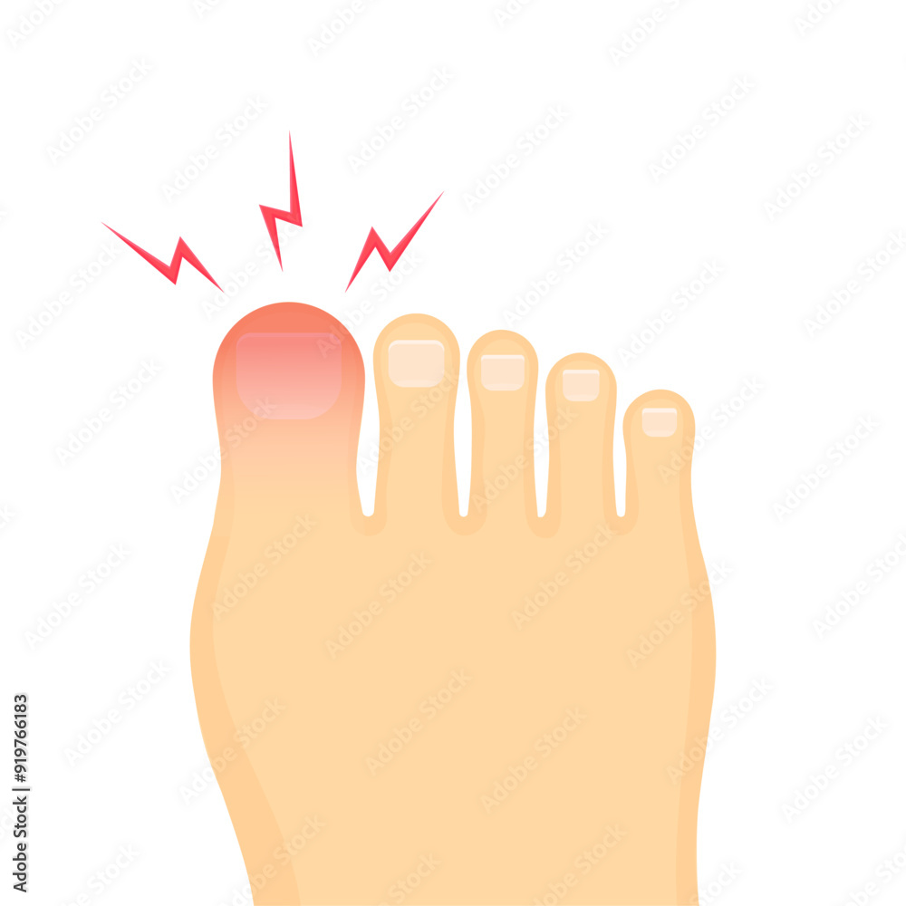 Sore big toe in cartoon style on a white background. Image of a finger ...