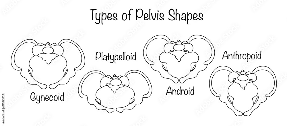 Types of Pelvis Shapes Stock Vector | Adobe Stock