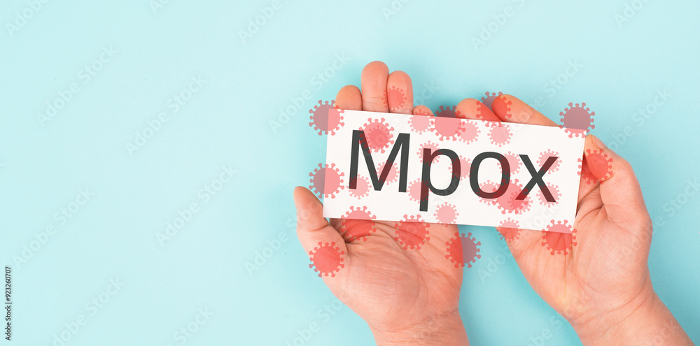 Mpox, hands with monkeypox rash, outbreak of the MPXV virus, infectious disease spreading Stock ...