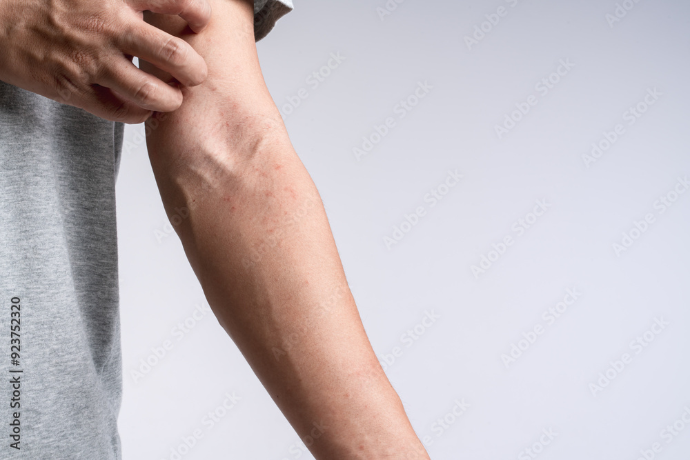 Person scratching their arm with skin irritation or rash from food or ...