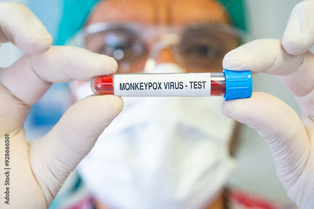 Monkeypox Virus (Maymun Çiçeği) Test Kit in the Lab Photo, Uskudar ...