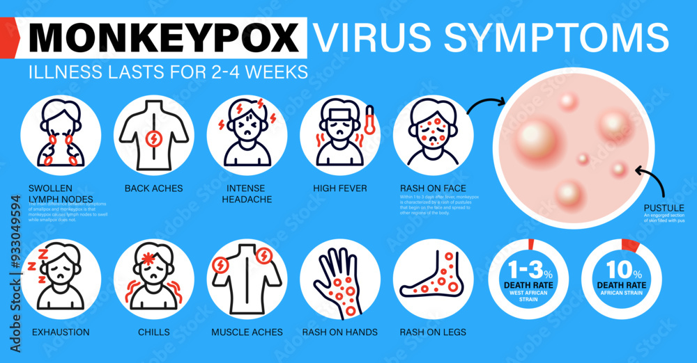 Monkeypox virus Symptoms. New cases of Monkeypox virus are reported in ...