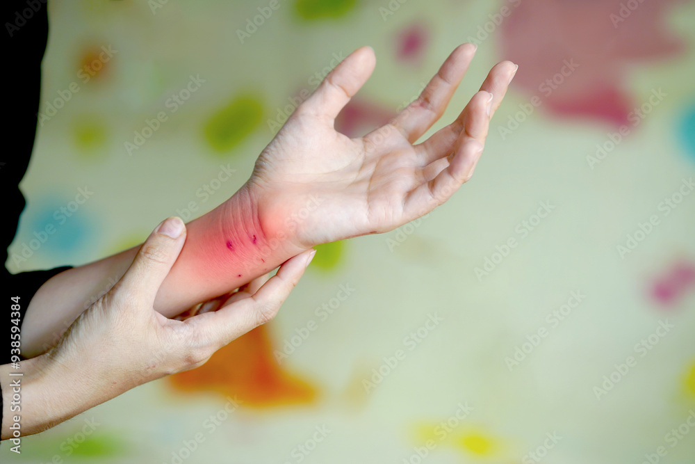 Person holding a red and swollen wrist with scratches, depicting pain ...