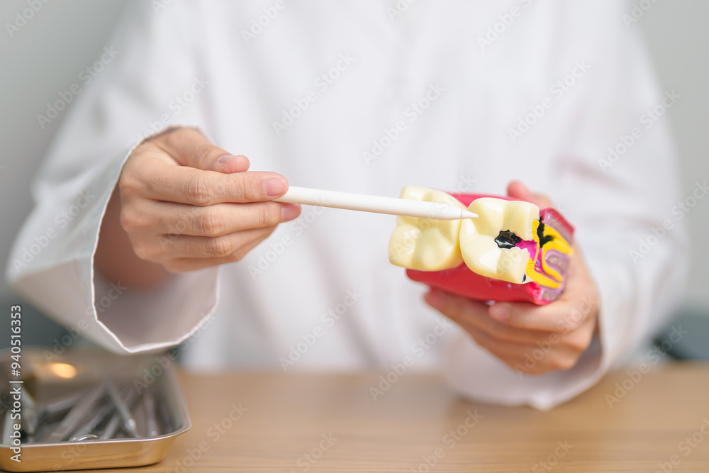 Dentist with tooth Anatomy model. Oral Teeth decay and disease, Scrape ...
