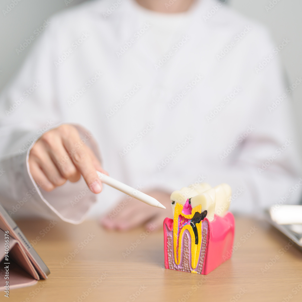 Dentist with tooth Anatomy model. Oral Teeth decay and disease, Scrape ...