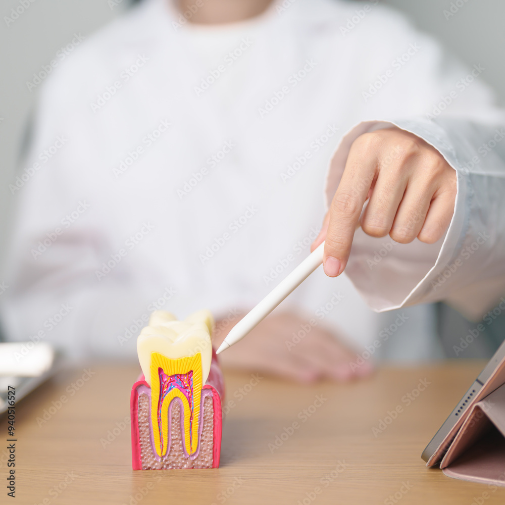Dentist with tooth Anatomy model. Oral Teeth decay and disease, Scrape ...