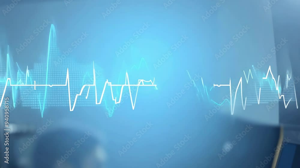 Close-up of a Dynamic Heartbeat EKG Graph on a Modern Medical Screen ...