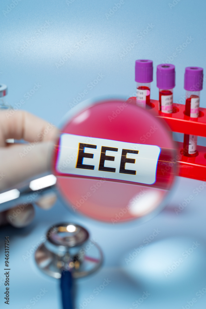 Eastern Equine Encephalitis (EEE) is an extremely rare but serious and ...