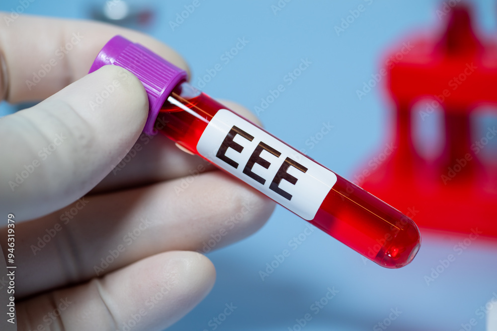 Eastern Equine Encephalitis (EEE) is an extremely rare but serious and ...