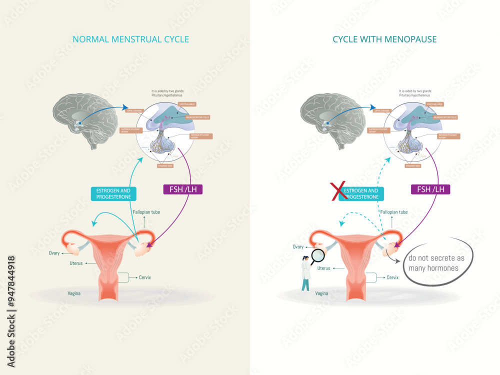 Comparative image explaining the differences between a normal menstrual ...
