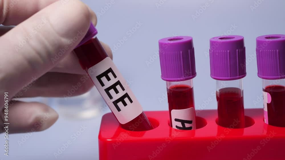 Eastern Equine Encephalitis (EEE) is an extremely rare but serious and ...