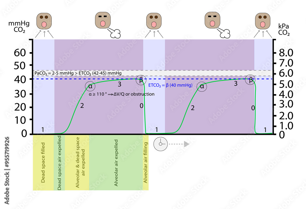 Capnography Waveform Detailed Infographic Stock Illustration | Adobe Stock