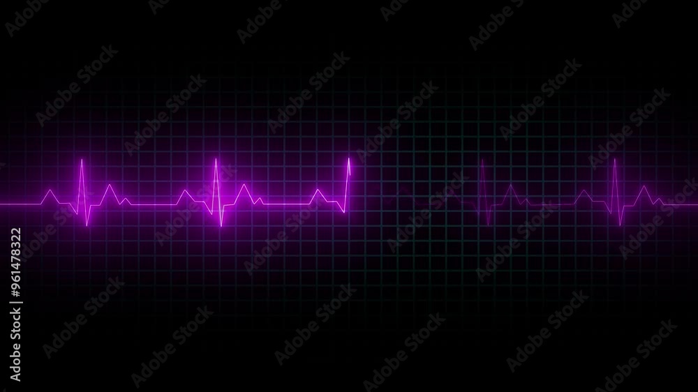 EKG Heartbeat reading animation on black background in 4K. Medical ...