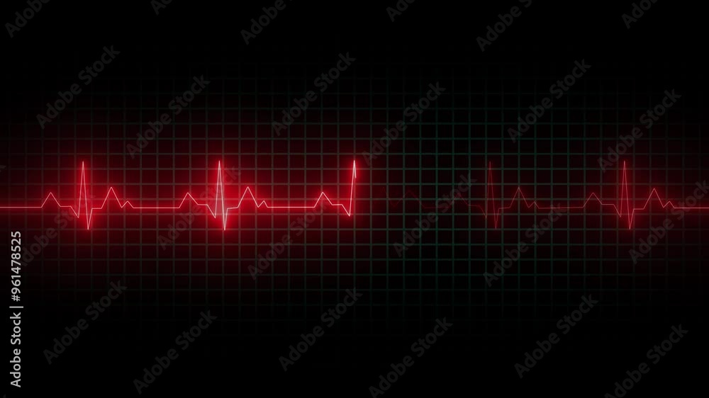 EKG Heartbeat reading animation on black background in 4K. Medical ...