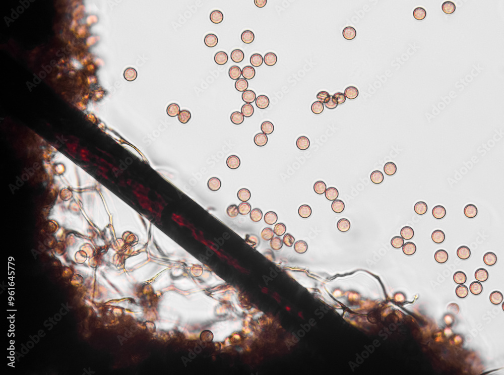 Spores, sporangia, mycelium, hypha of Stemonitis Splendens slime mold ...