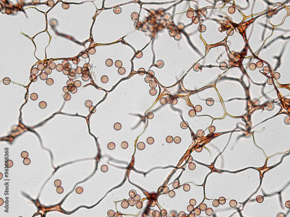 Spores, sporangia, mycelium, hypha of Stemonitis Splendens slime mold ...