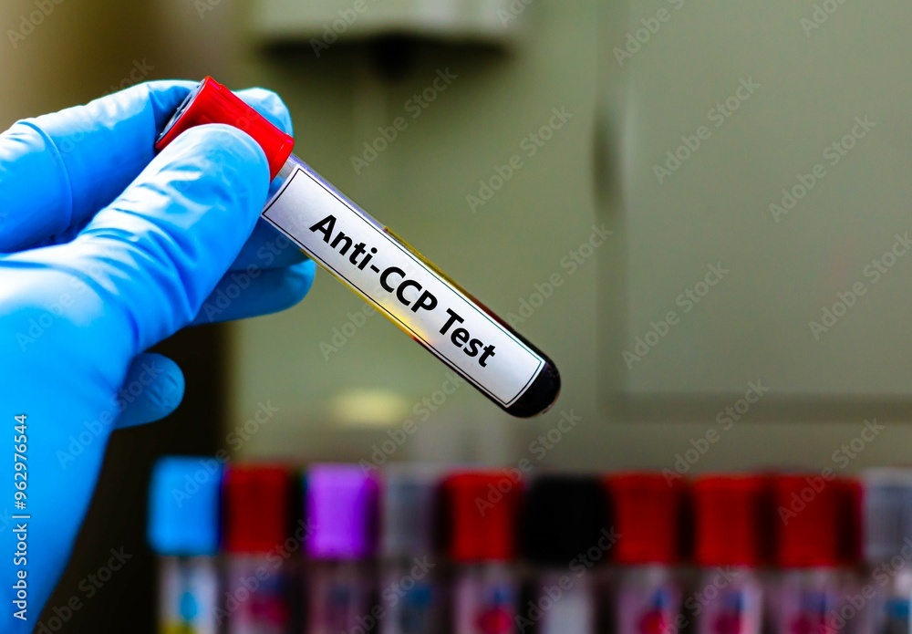 Blood sample tube for ant-CCP test analysis. Stock Photo | Adobe Stock