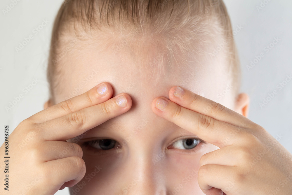 The girl holds her forehead and head with her fingers. Concept of pain ...