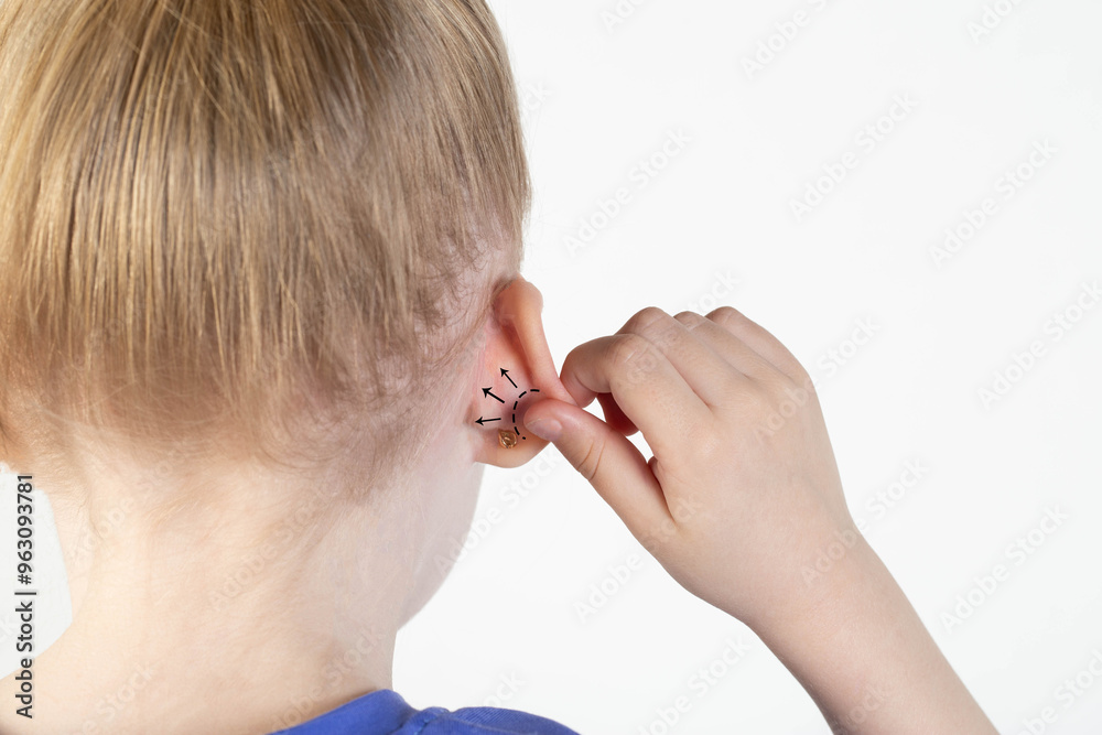 The girl holds her hand on her protruding protruding ear with marks for ...