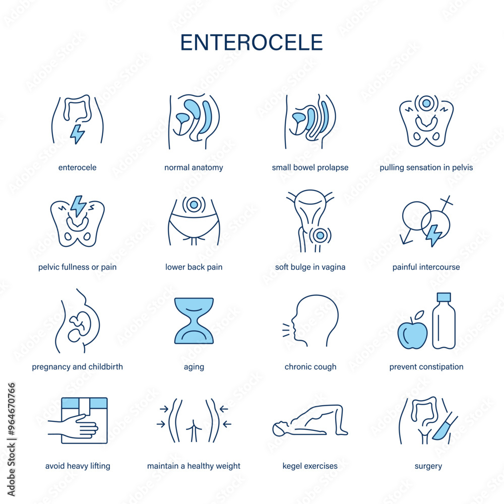 Enterocele symptoms, diagnostic and treatment vector icons. Medical ...