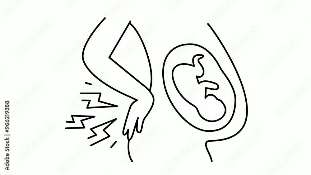 Women having Backache animation, back pain during pregnancy animated ...