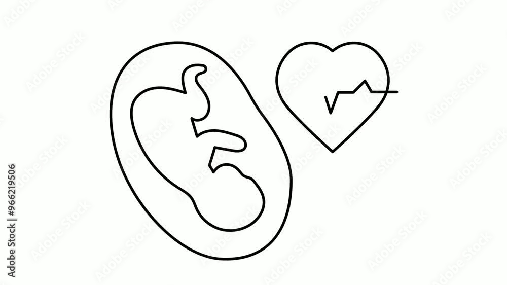 Fetal Heart Monitoring or Pregnant women Ultra Sound animation, Fetus ...