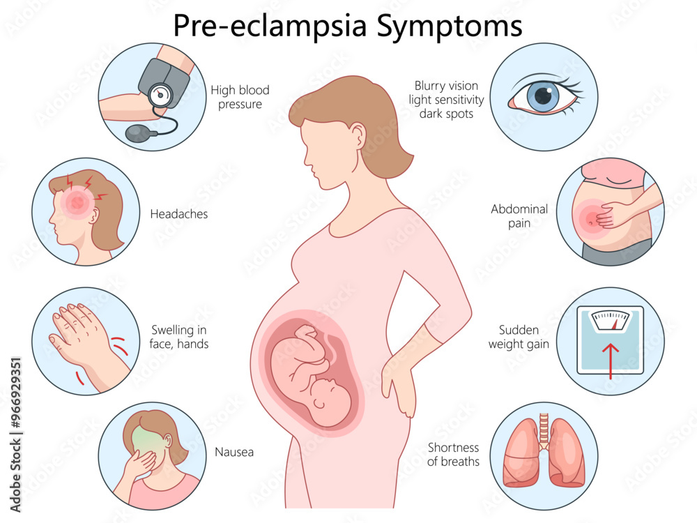 Photo & Art Print key symptoms of pre-eclampsia in pregnant women, high blood pressure ...
