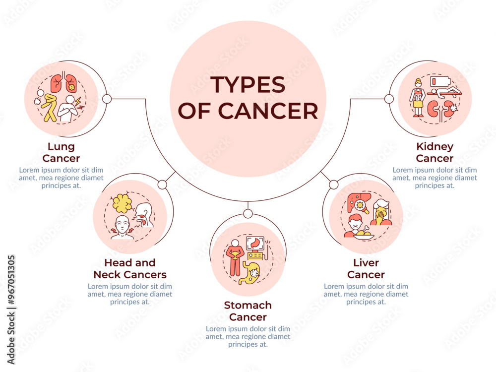 Types of oncological diseases circular diagram infographic. Lung and ...